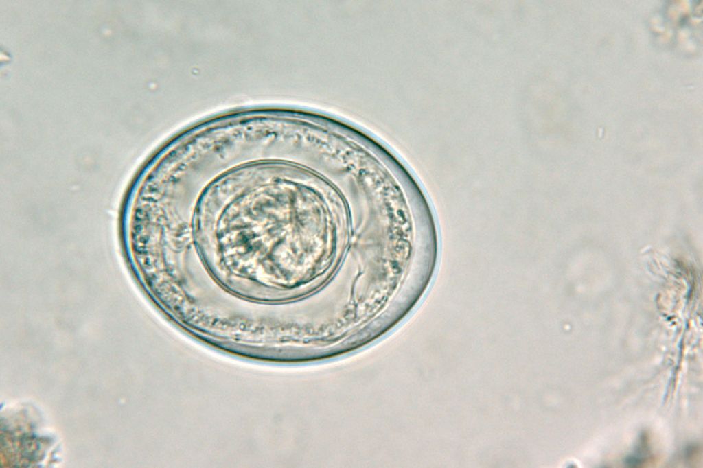 Hymenolepiasis | Parasite Diagnosis