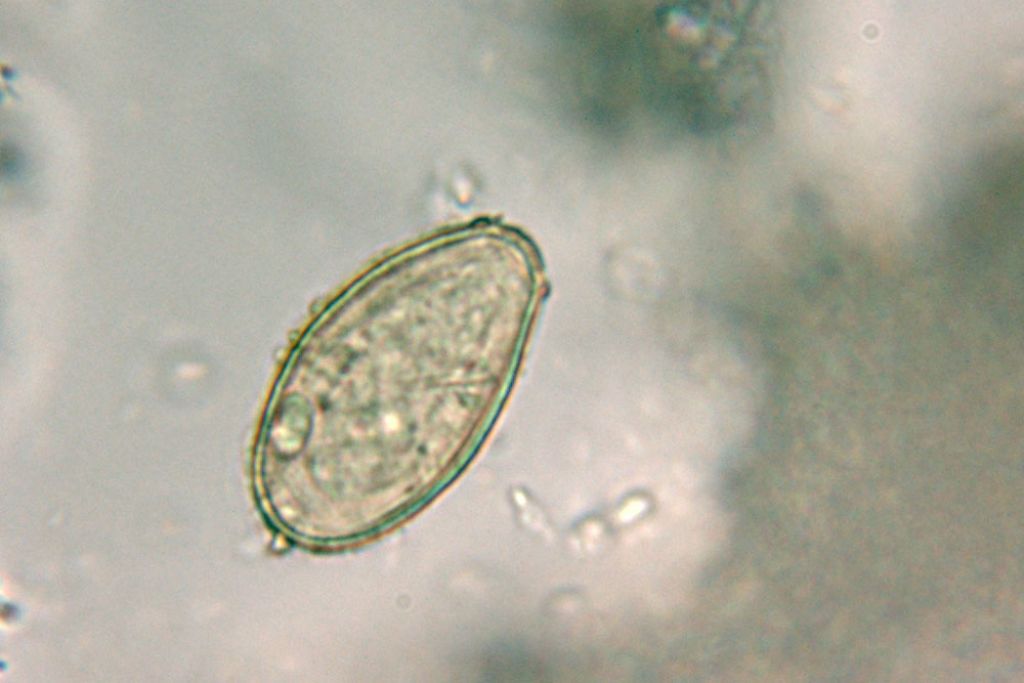 Opisthorchiasis Parasite Diagnosis 6084