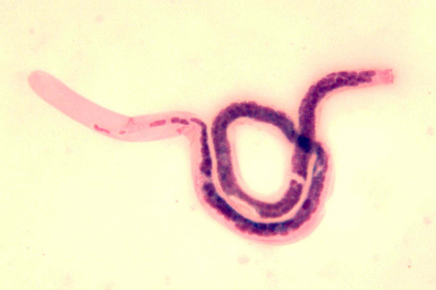 Lymphatic filariasis | Parasite Diagnosis