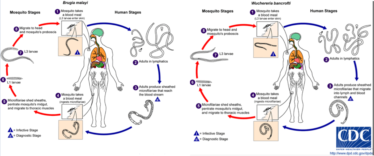 Lymphatic filariasis | Parasite Diagnosis