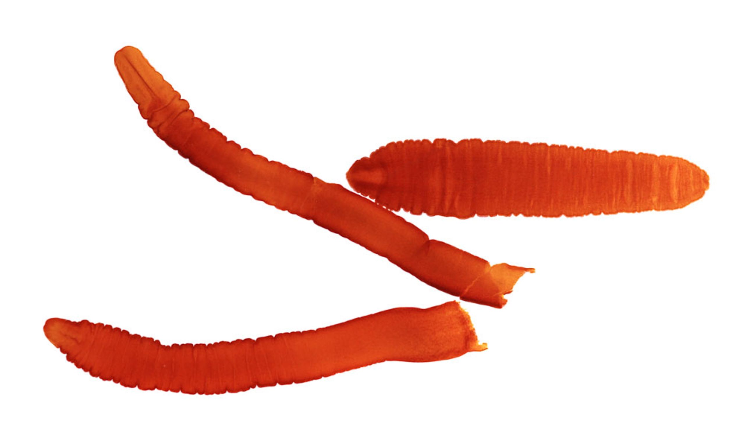 Diphyllobothriasis | Parasite Diagnosis