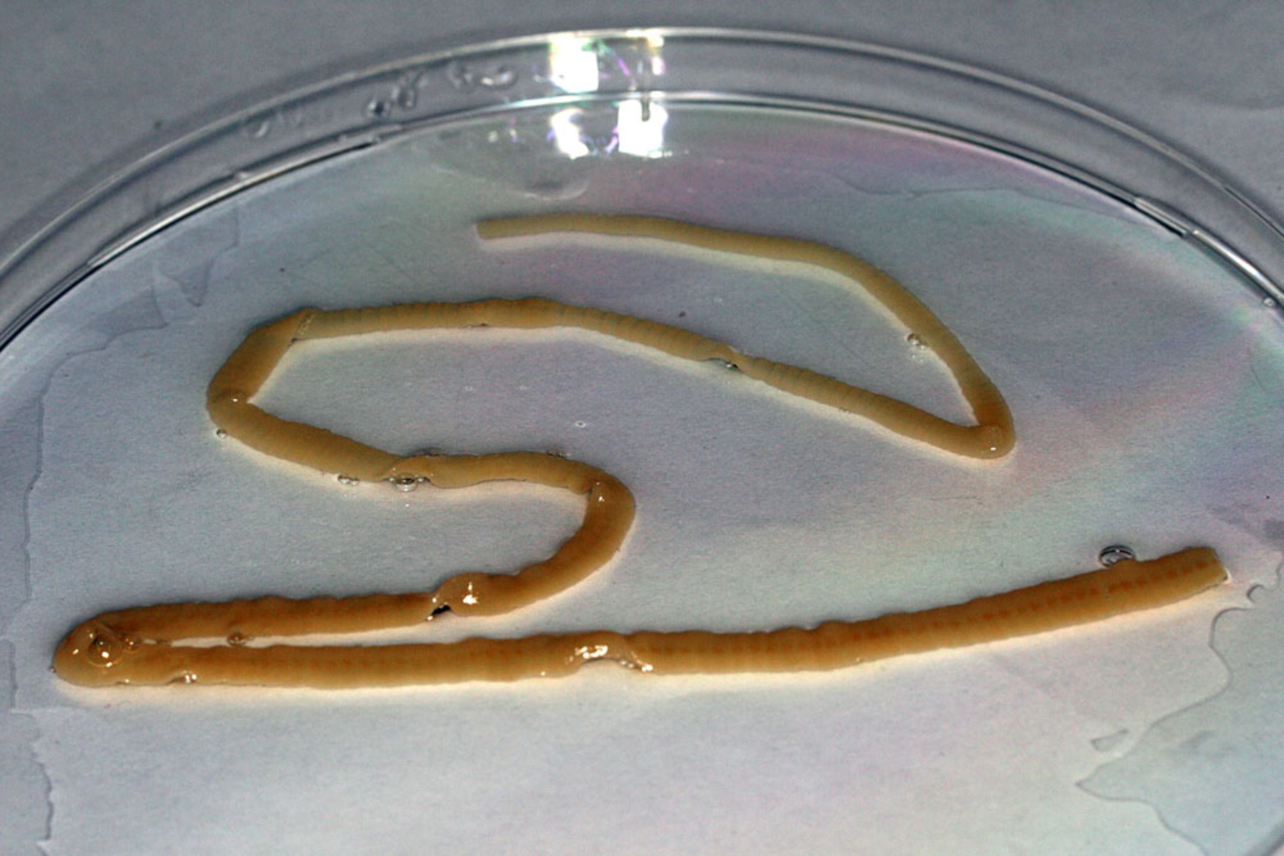 Diphyllobothriasis | Parasite Diagnosis
