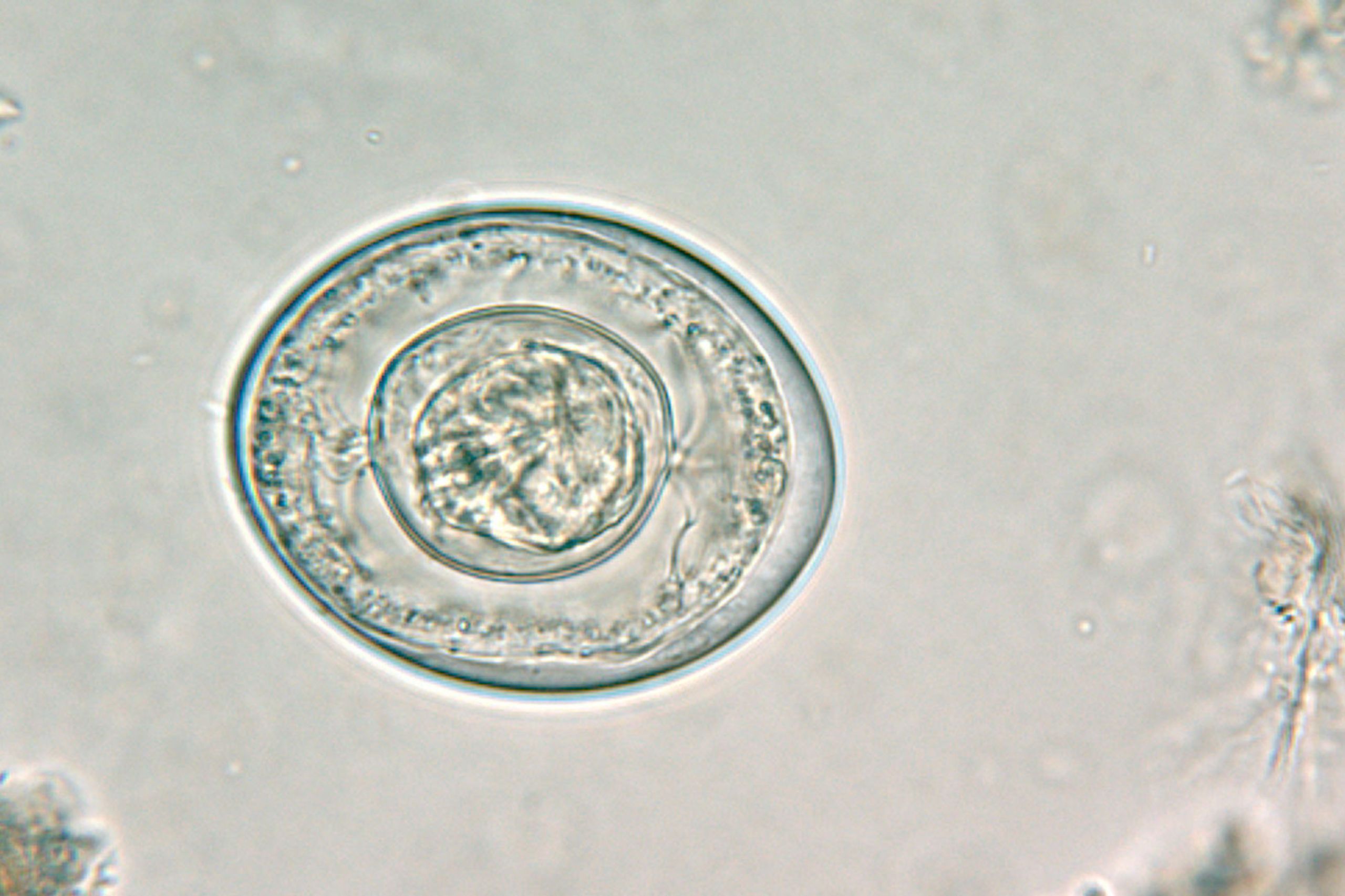 Hymenolepiasis | Parasite Diagnosis