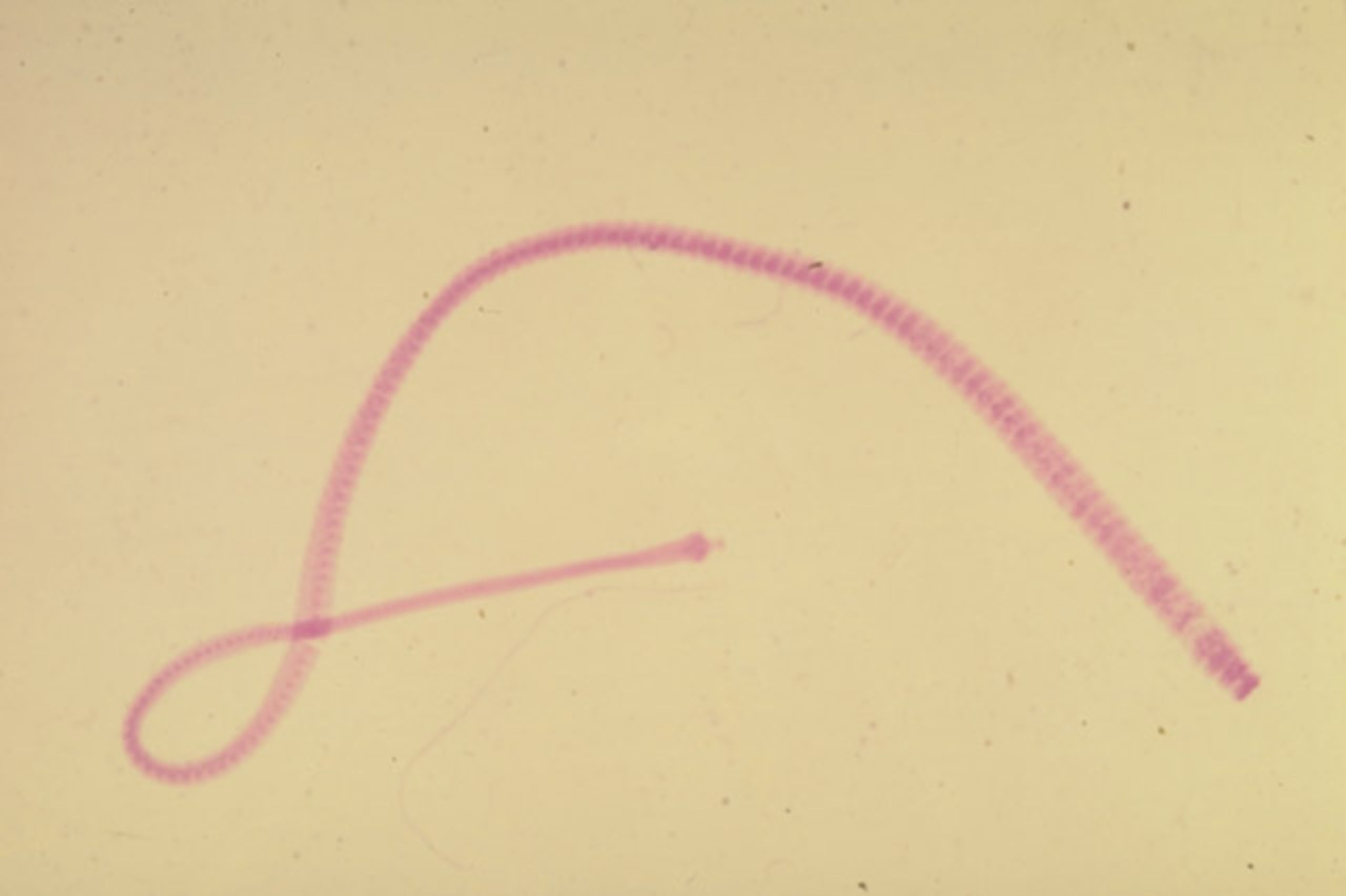 Hymenolepiasis | Parasite Diagnosis