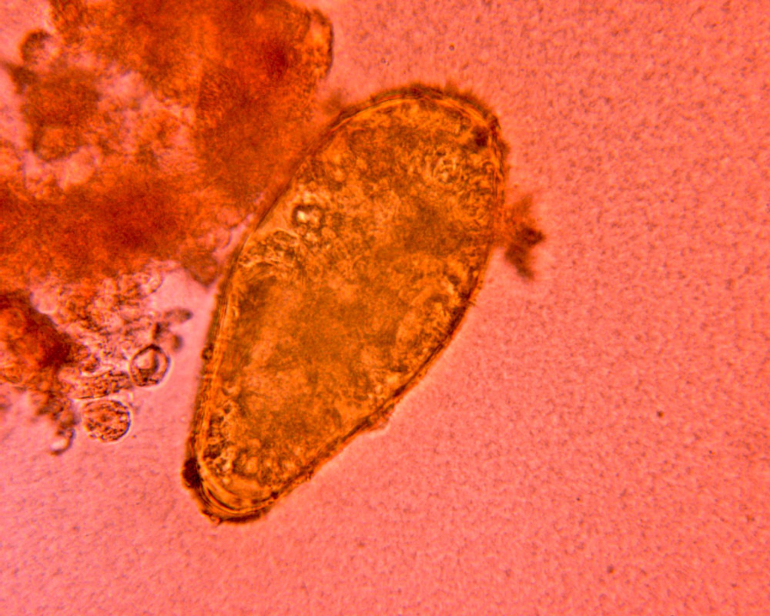 Paragonimiasis | Parasite Diagnosis