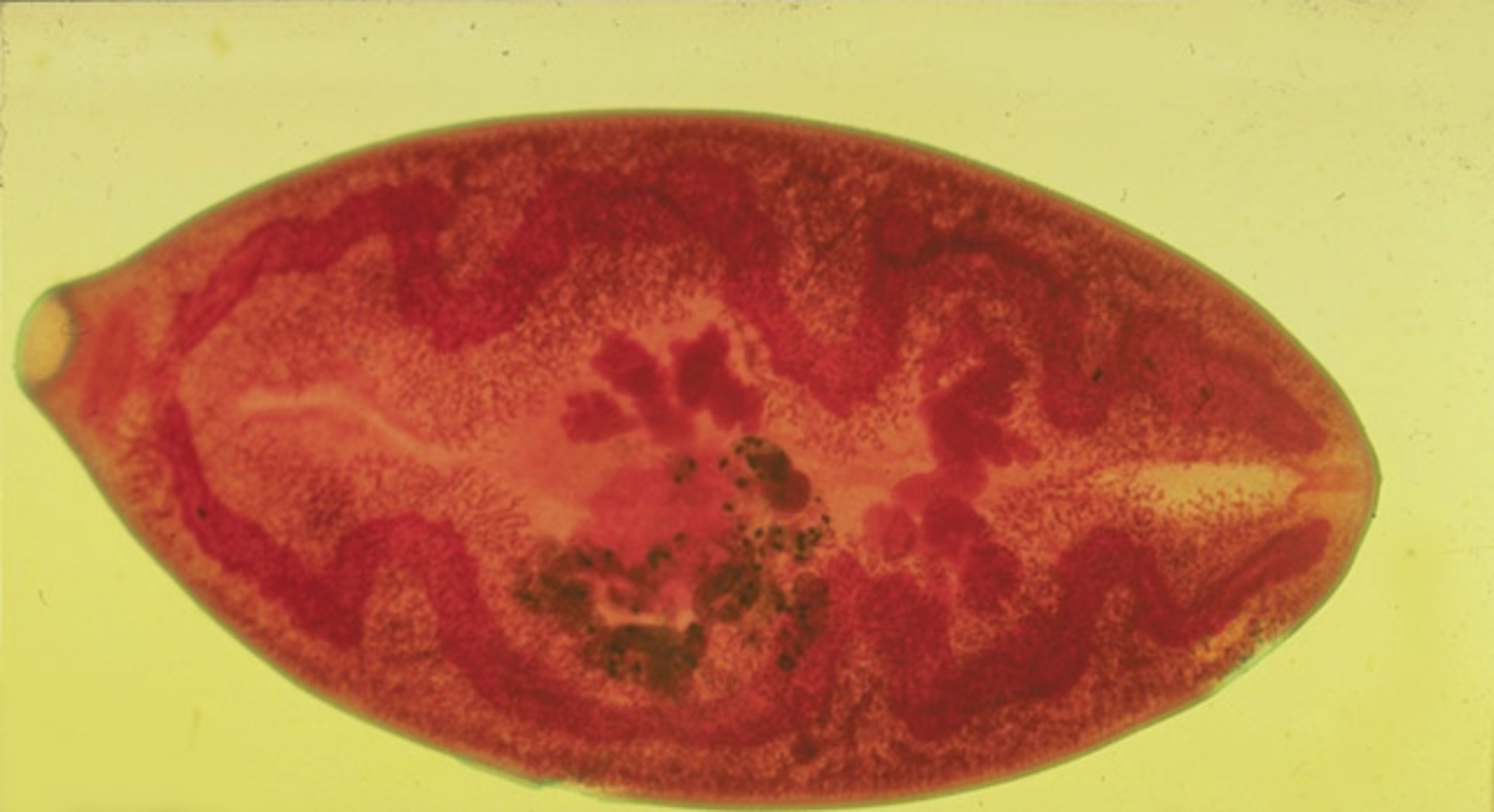 Paragonimiasis | Parasite Diagnosis
