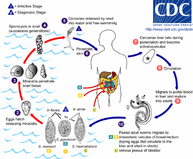 Schistosomiasis, urinary | Parasite Diagnosis