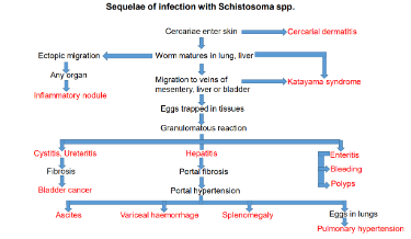 Schistosomiasis, urinary | Parasite Diagnosis