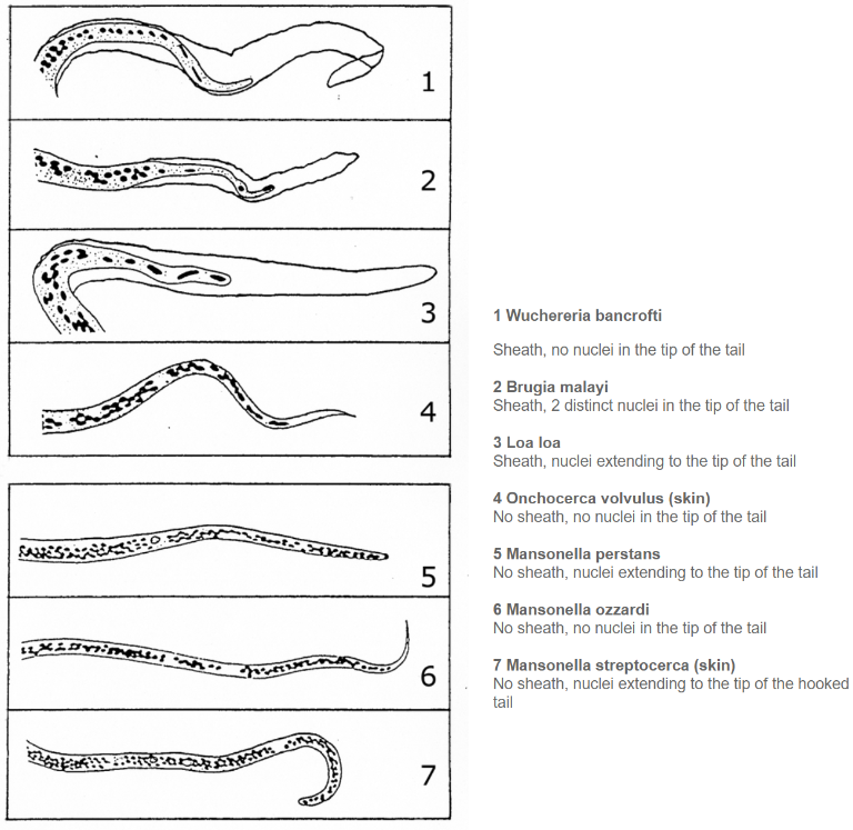 Microfilariae | Parasite Diagnosis